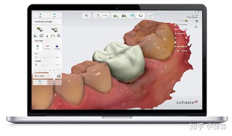 全新 3shape口扫 Trios 3 Basic 知乎