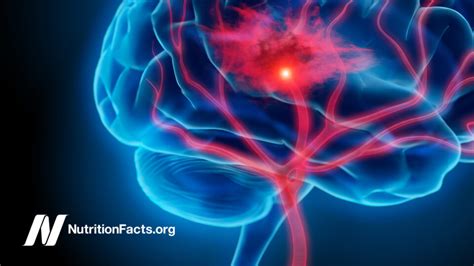 Eating For Stroke Prevention Empowered 4 Health