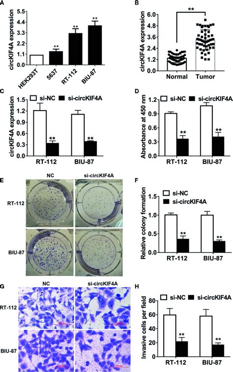 Circular Rna Circkif4a Sponges Mir 3751231 To Promote Bladder Cancer