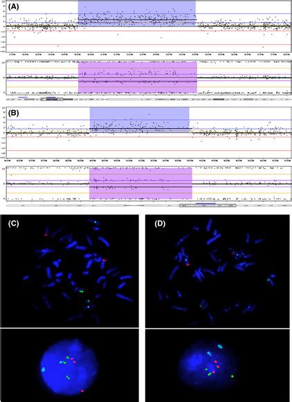 Snp Chromosomal Microarray And Fish Analyses Two Representative Download Scientific Diagram Snp Chromosomal Microarray And Fish Analyses Two Representative Download Scientific Diagram