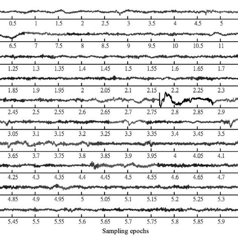 PDF Design And Implementation Of Wireless Multi Channel EEG Recording System And Study Of EEG