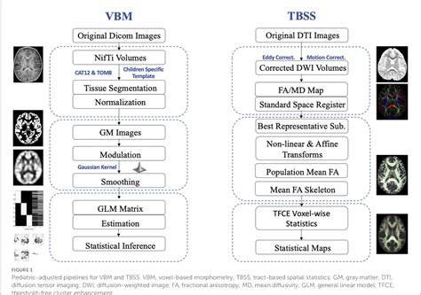 Figure 1 From Brain Structural Alterations In Young Girls With Rett