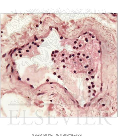 Capillary Histology