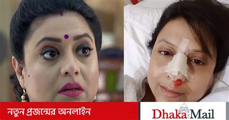 নাকে একাধিক ব্যান্ডেজ অভিনেত্রীর