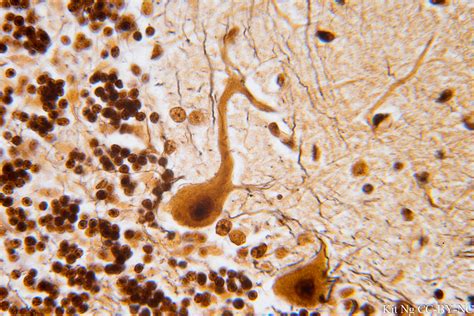 Neuron Kit Ng Ph D