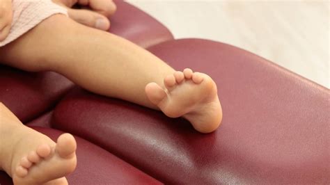 Metatarsus Adductus East Coast Podiatry Singapore