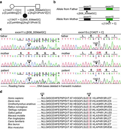 Identification Of Compound Heterozygous Mutations In The Nbas Gene In