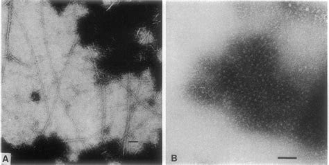 Electron Micrographs Of Negatively Stained Preparations Showing The