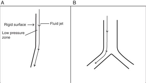 Diagrammatic Illustration Of The Coanda Effect A General Principle