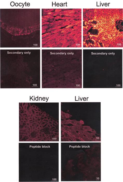 Expression Of Mct8 In Xenopus Oocytes And Various Rat Tissues And