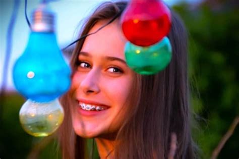 How To Know If You Need Braces A Comprehensive Guide