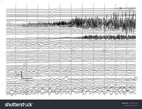 Brain Eeg Electrodes Over 163 Royalty Free Licensable Stock Vectors
