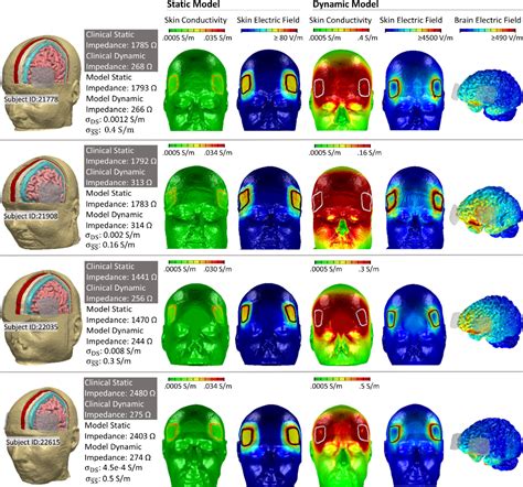 Figure 1 From Adaptive Current Flow Models Of Ect Explaining