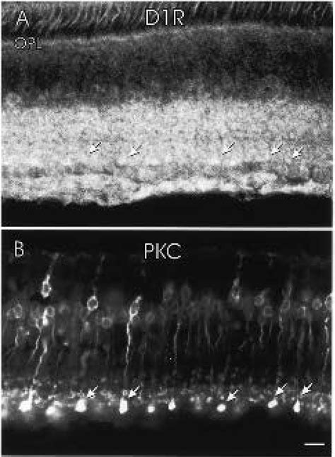 Dopamine Receptor — D1r Ir Was Weak In The Opl Download Scientific