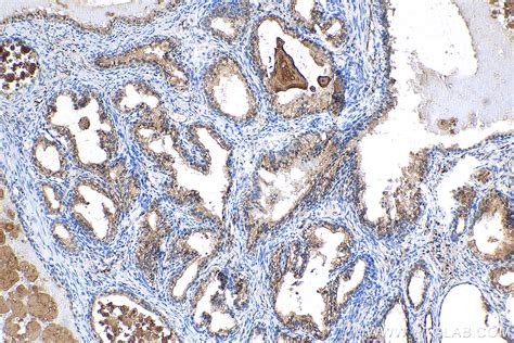 Beta 2 Microglobulin Antibody 13511 1 Ap Proteintech 武汉三鹰生物技术有限公司
