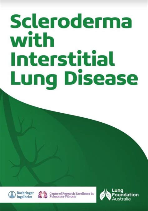 Scleroderma With Interstitial Lung Disease Ild Lung Foundation