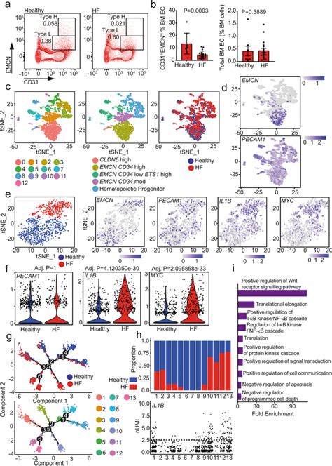 Il1b Is Upregulated In Emcn Rich Endothelial Cells In Post Myocardial
