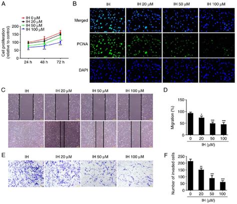 Ih Inhibits The Proliferation Migration Invasion Of Keloid