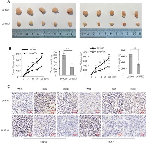 WTX Suppresses Liver Tumor Growth In Vivo Subcutaneous Xenografts Of
