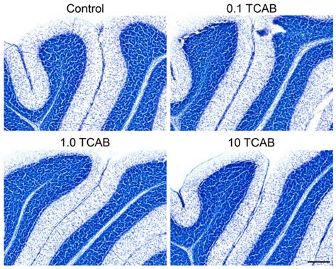 Nissl Staining Of Cerebellum At Pnd21 Download Scientific Diagram