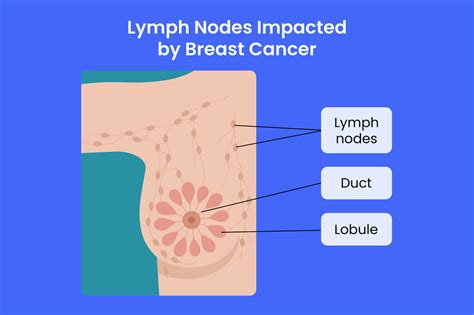 What Do Enlarged Lymph Nodes In Armpit Mean
