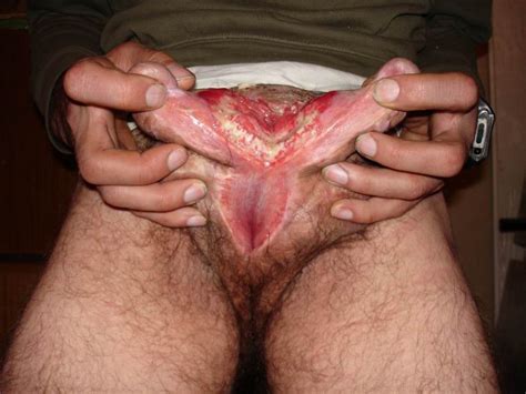 Very Extremely Weird Cocks Porn Pictures Xxx Photos Sex Images