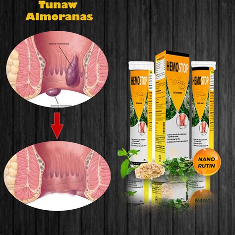 Hemostop Effervescent Tablet For People Get Hemorrhoid Makati