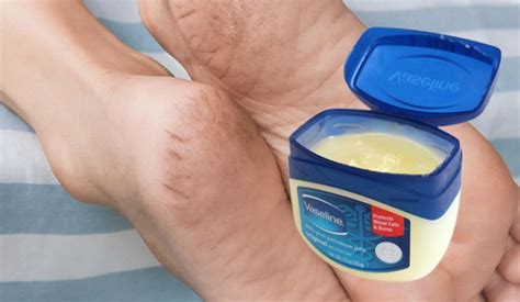 3 cách trị nứt gót chân bằng Vaseline hiệu quả ngay tại nhà HAYAN VN