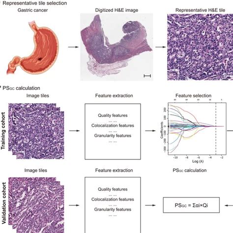 Pdf Prognostic And Predictive Value Of A Pathomics Signature In