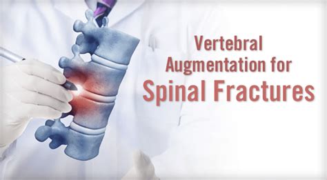 Vertebral Augmentation For Spinal Fractures Physician S Weekly