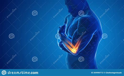 Pain In The Elbow Joint Stock Illustration Illustration Of Ulna