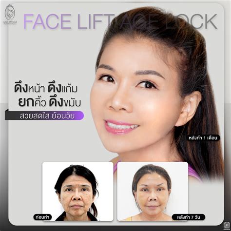 โรงพยาบาลเลอลักษณ์ ศัลยกรรมตกแต่ง Lelux Surgery Hospital
