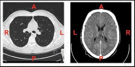 Medical Imaging Ai Ml Engineering Guide Best Practices And Examples