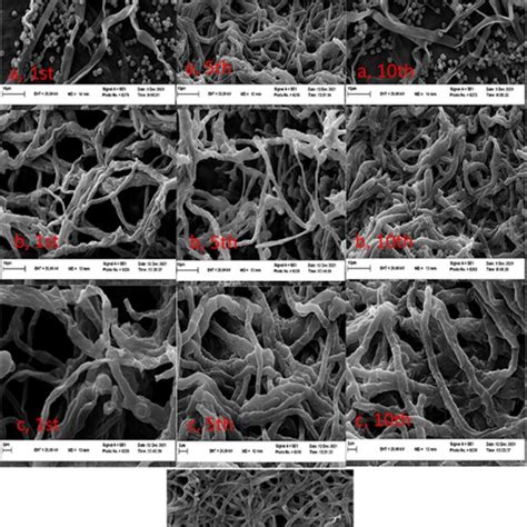 Bioassay Of Obtained Supernatant Of Fermentation Medium Of T Inflatum