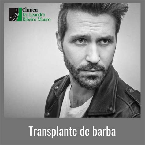 Transplante De Barba Transplante Capilar Curitiba
