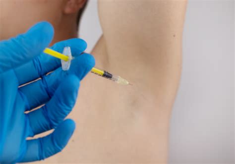 Specialist Dr Burcu Demirdover Excessive Sweating Hyperhidrosis