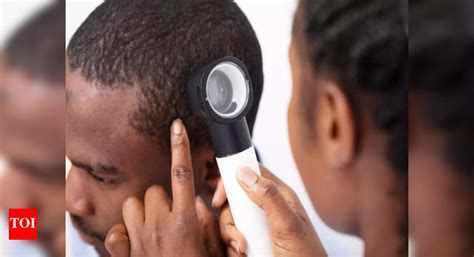 Scalp Pimple And Home Hacks To Get Rid Of Them Times Of India