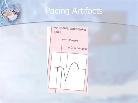 Temporary Pacemakerpptx Heart And Cardiovascular Diseases Diseases And Conditions