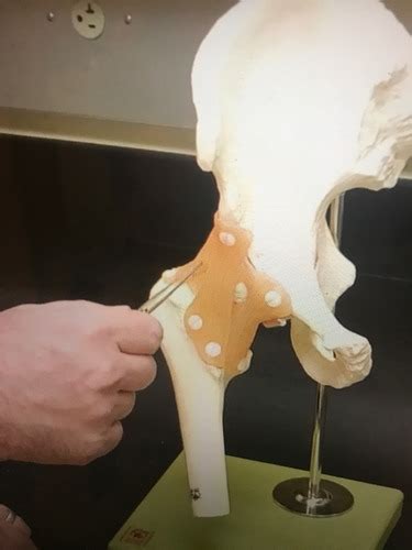 Hip Flashcards Quizlet