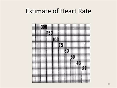 12 Lead Ekg Interpretation Pdfdrive Pdf