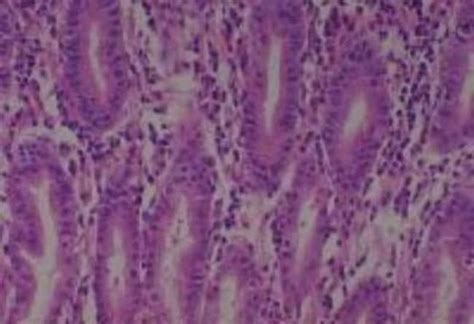 Novus Biologicals™ Stomach Matched Cancer And Normal Tissue Microarray