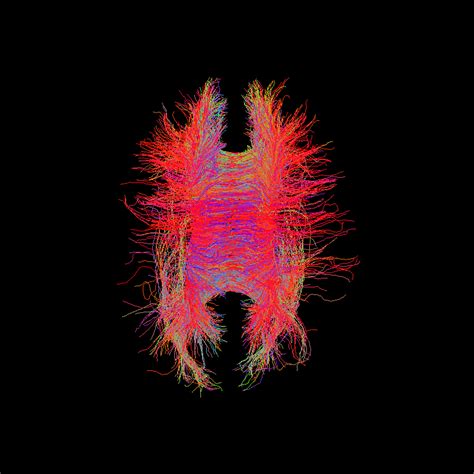 Dipy Docs 150 Particle Filtering Tractography