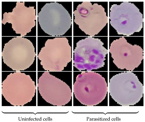 Applied Sciences Free Full Text Deep Malaria Parasite Detection In Thin Blood Smear