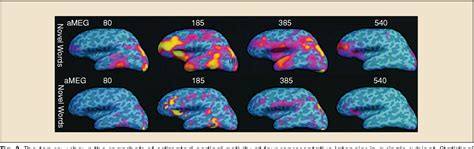 Figure 1 From Integration Of Eegmeg With Mri And Fmri Semantic Scholar