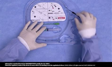 Deployment For Emboshield Nav6 Embolic Protection System Abbott