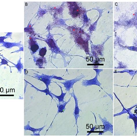 Morphology Of U87 Glioblastoma Cells A Untreated Cells Control