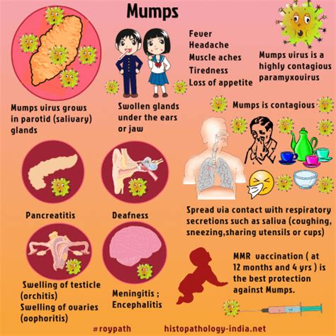 Pathology Of Mumps Dr Sampurna Roy Md