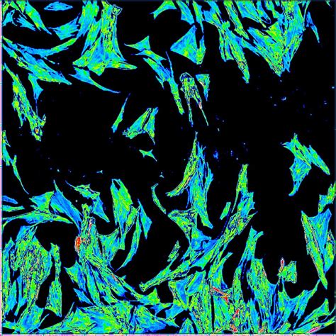 how to fix strange segmentation of secondary objects image analysis image sc forum