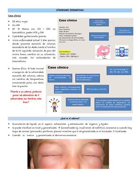 Síndrome Edematoso Pdf Edema Especialidades Medicas
