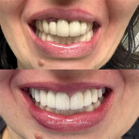 Milanka Nedeljkovicstomatolog Drnedeljkovickerkez • Instagram Photos And Videos